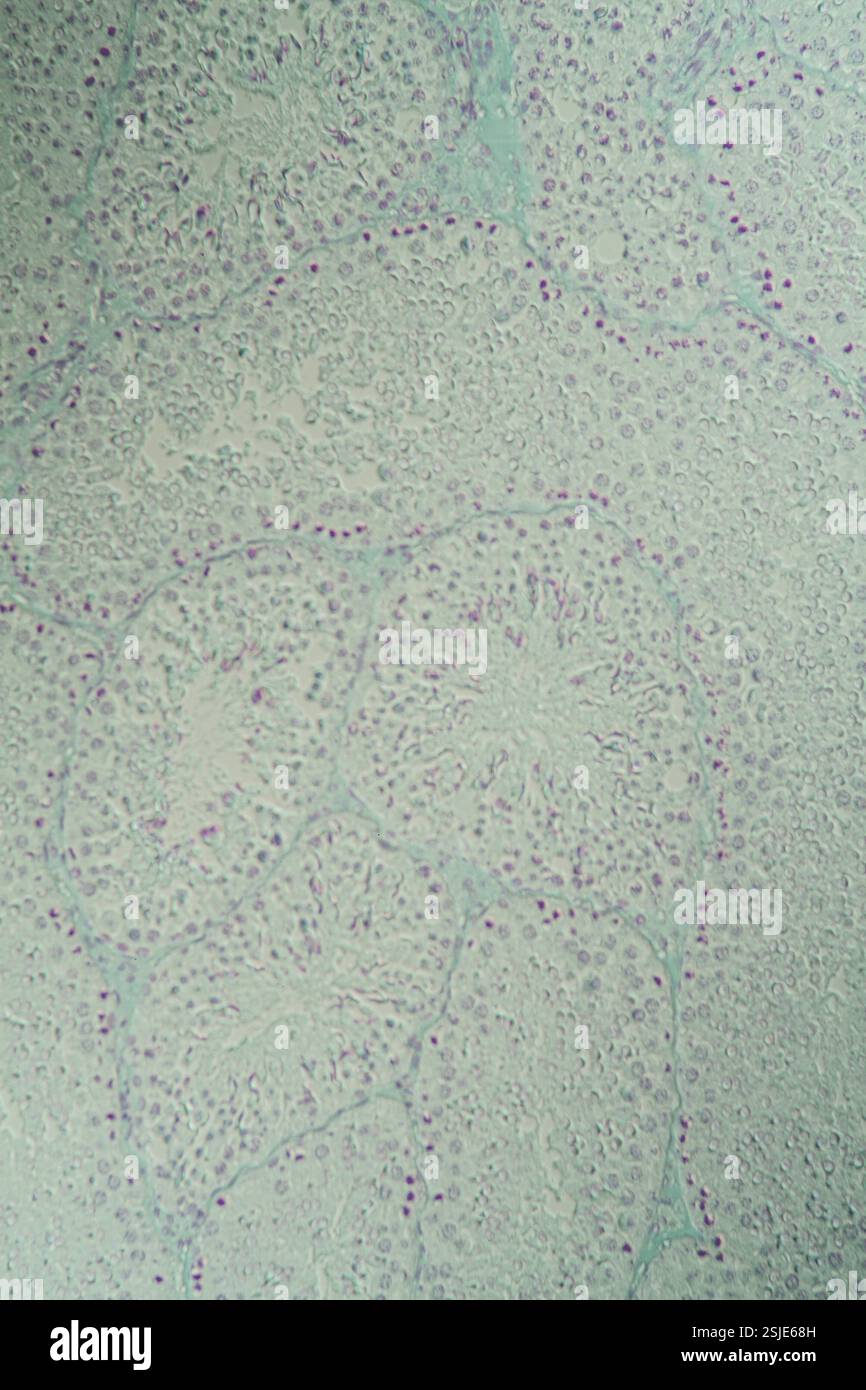 Testicle cross section under the microscope 200x Stock Photo - Alamy