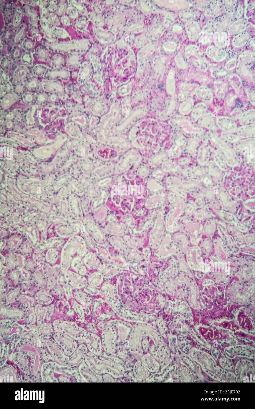 Cortex magnify hi-res stock photography and images - Alamy