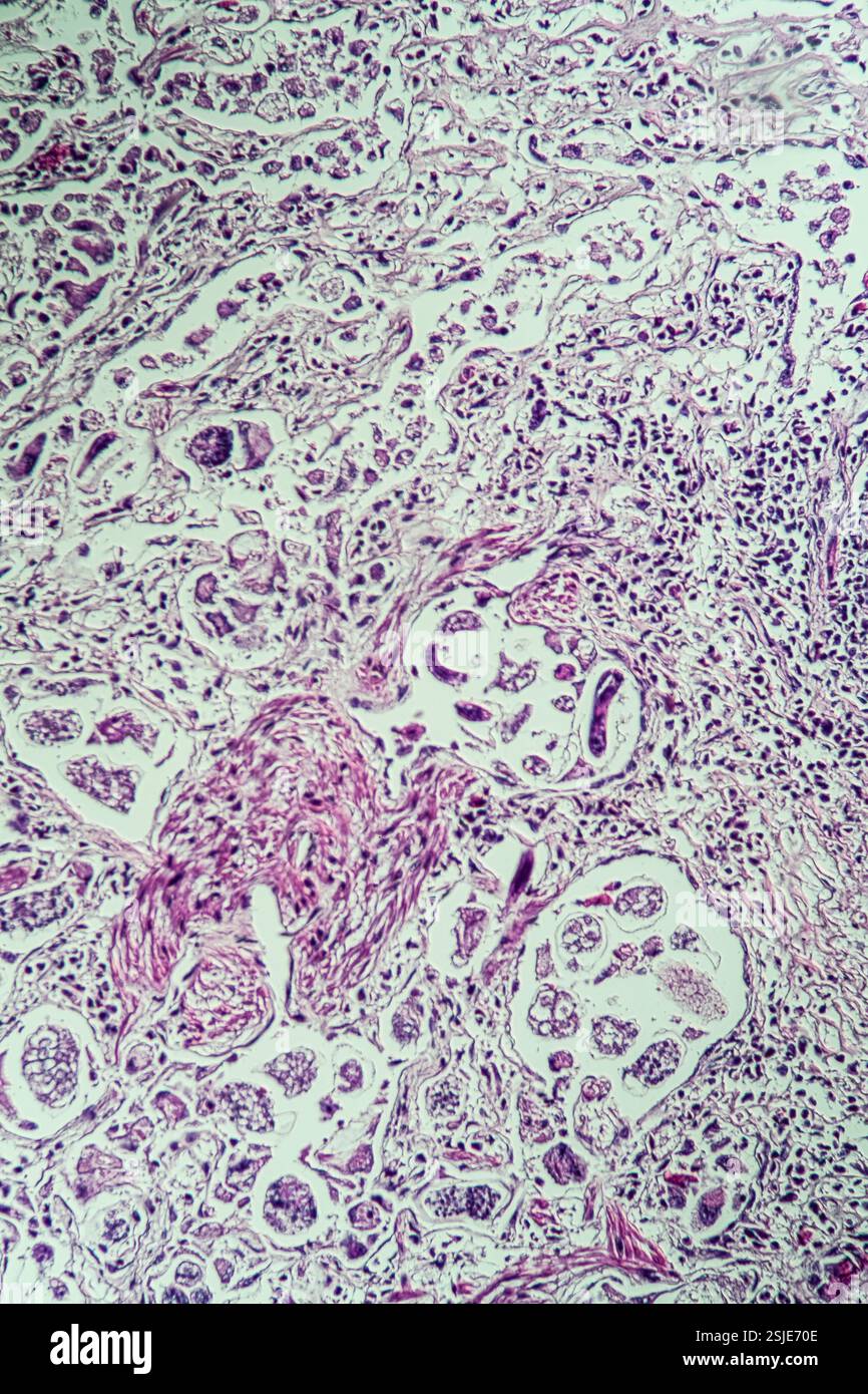 Lungworm in tissue under the microscope 200x Stock Photo - Alamy