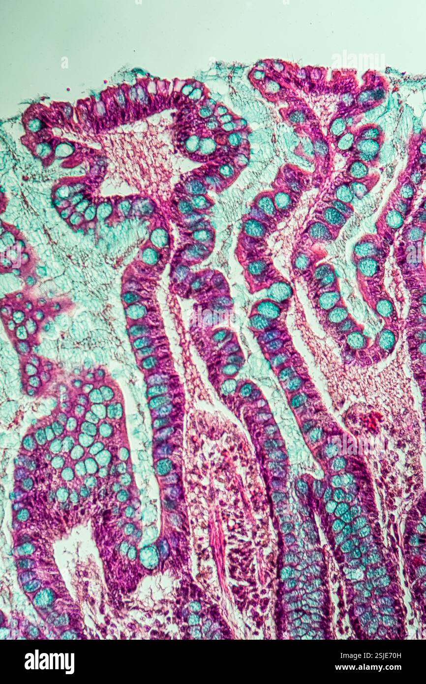 Small intestine with intestinal villi under the microscope 200x Stock ...