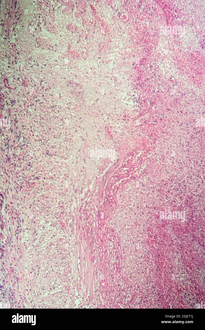 Tissue under the microscope 100x Stock Photo - Alamy