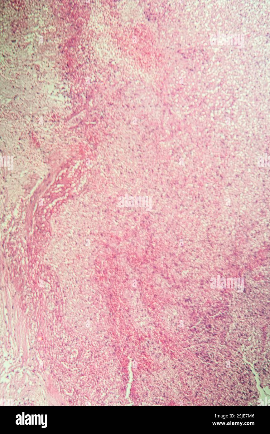 Gallbladder tissue under the microscope 100x Stock Photo - Alamy