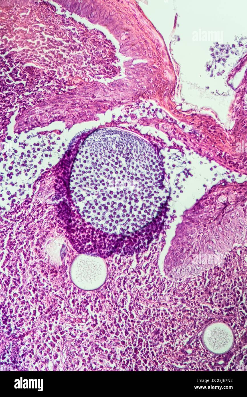 Nose diseased tissue under the microscope 200x Stock Photo - Alamy