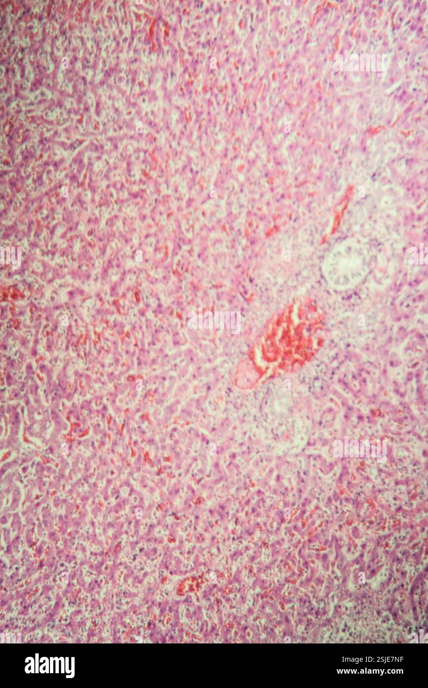 Hedgehog kidney after shock Tissue under the microscope 100x Stock ...