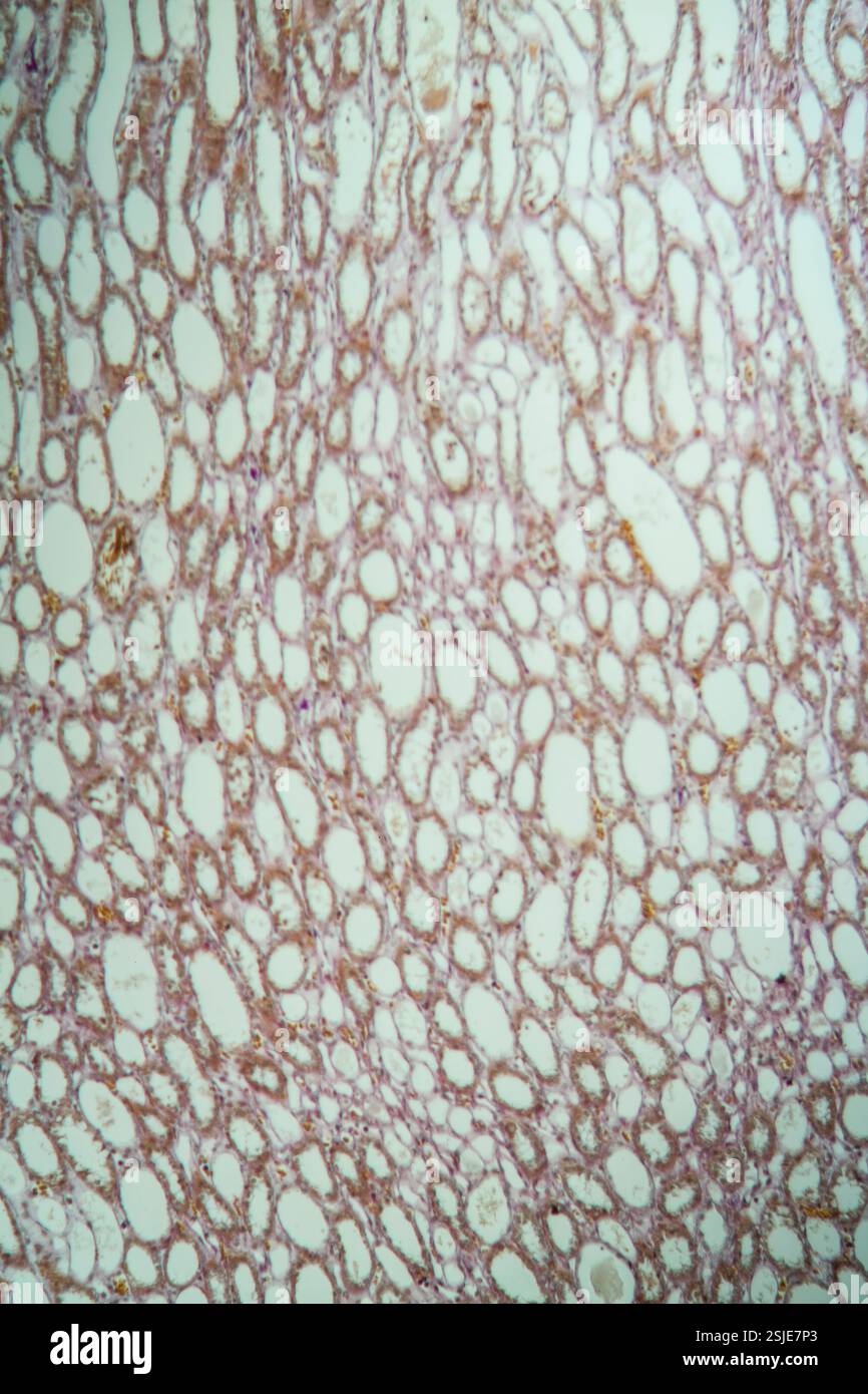 Healthy lung tissue under the microscope 100x hi-res stock photography ...