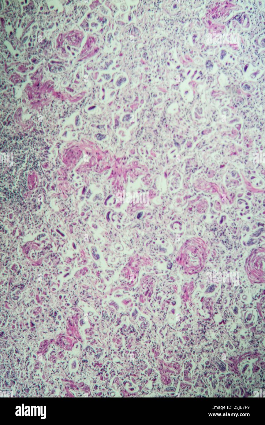 Lungworm in tissue under the microscope 100x Stock Photo - Alamy