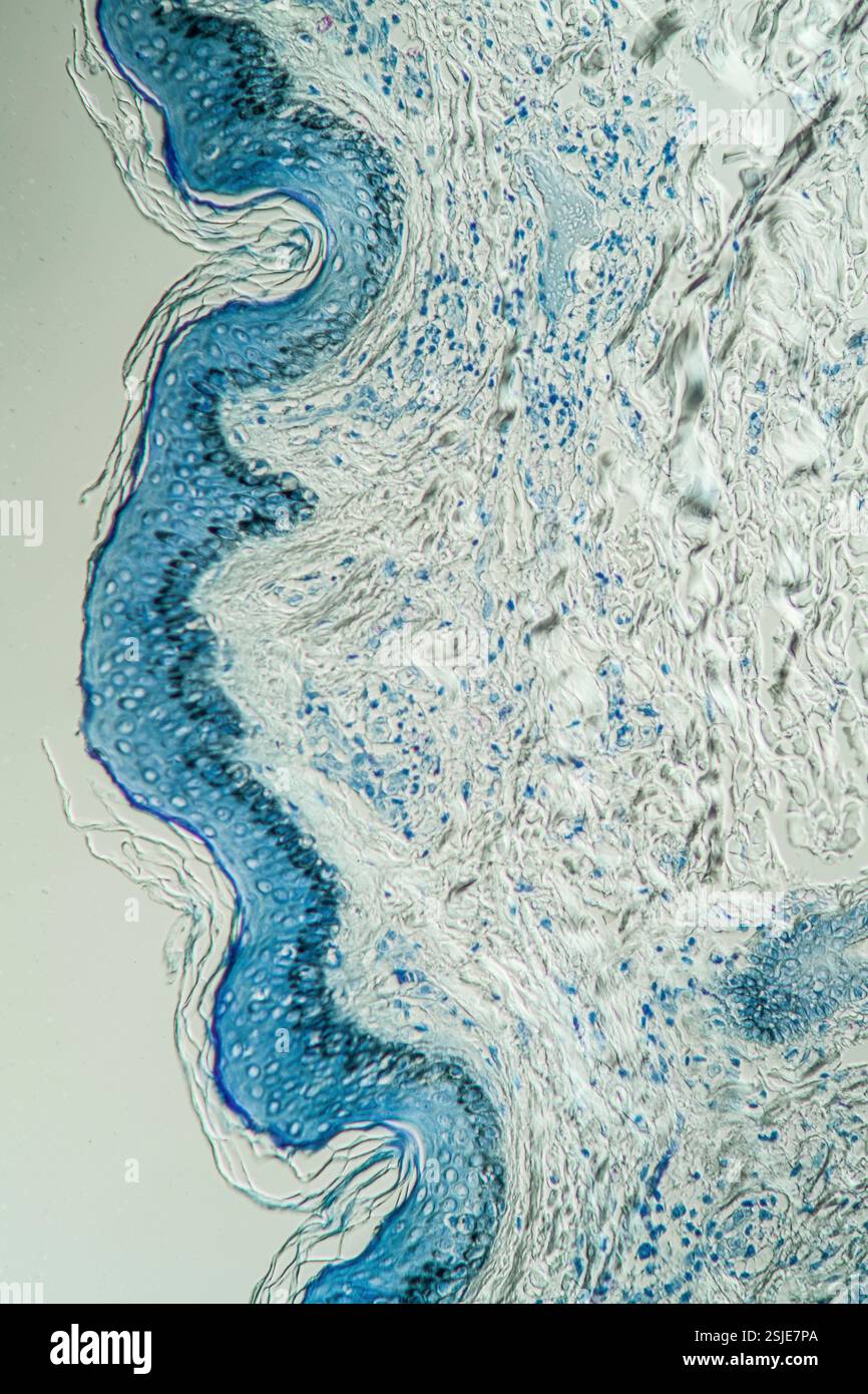 Leprosy under microscope hi-res stock photography and images - Alamy