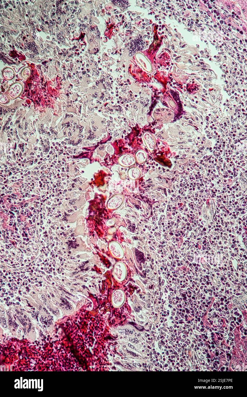Parasite eggs in tissue under the microscope 200x Stock Photo - Alamy