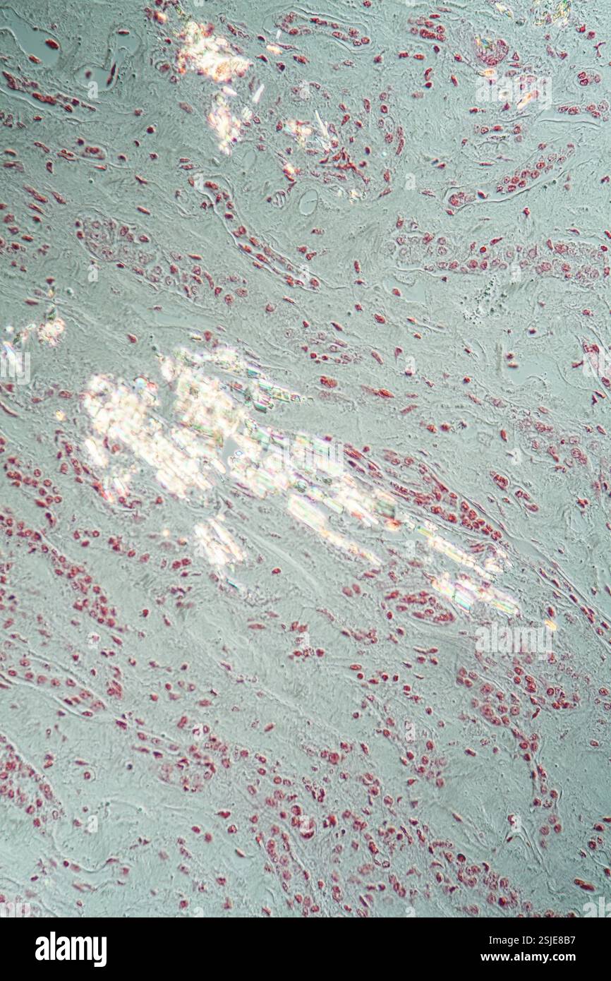 Kidney tissue under the microscope 200x Stock Photo - Alamy