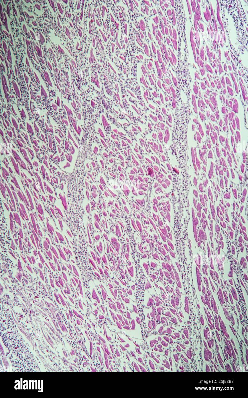 Inflamed heart muscle under the microscope 100x Stock Photo - Alamy