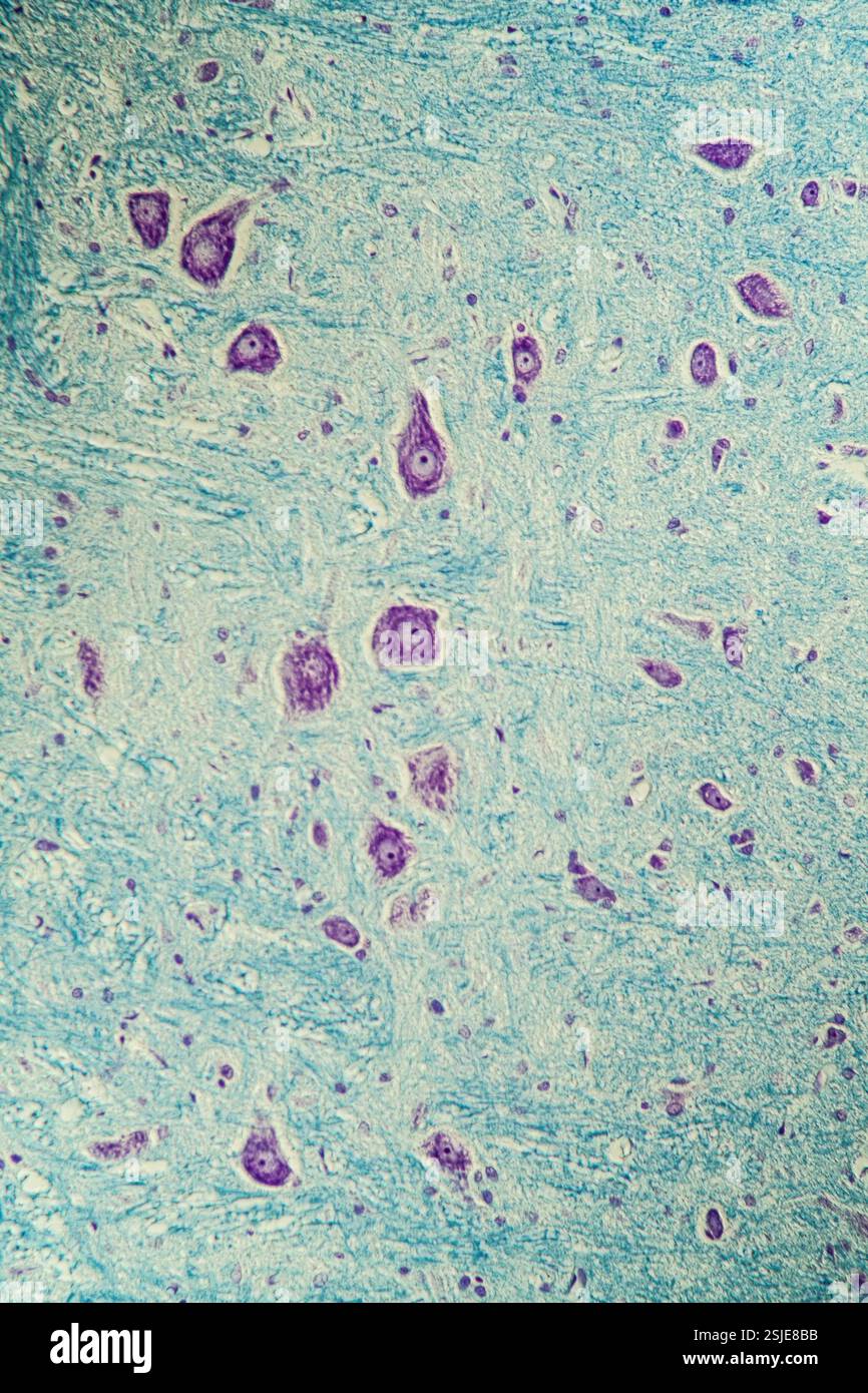 Nerve cells under the microscope 200x Stock Photo - Alamy