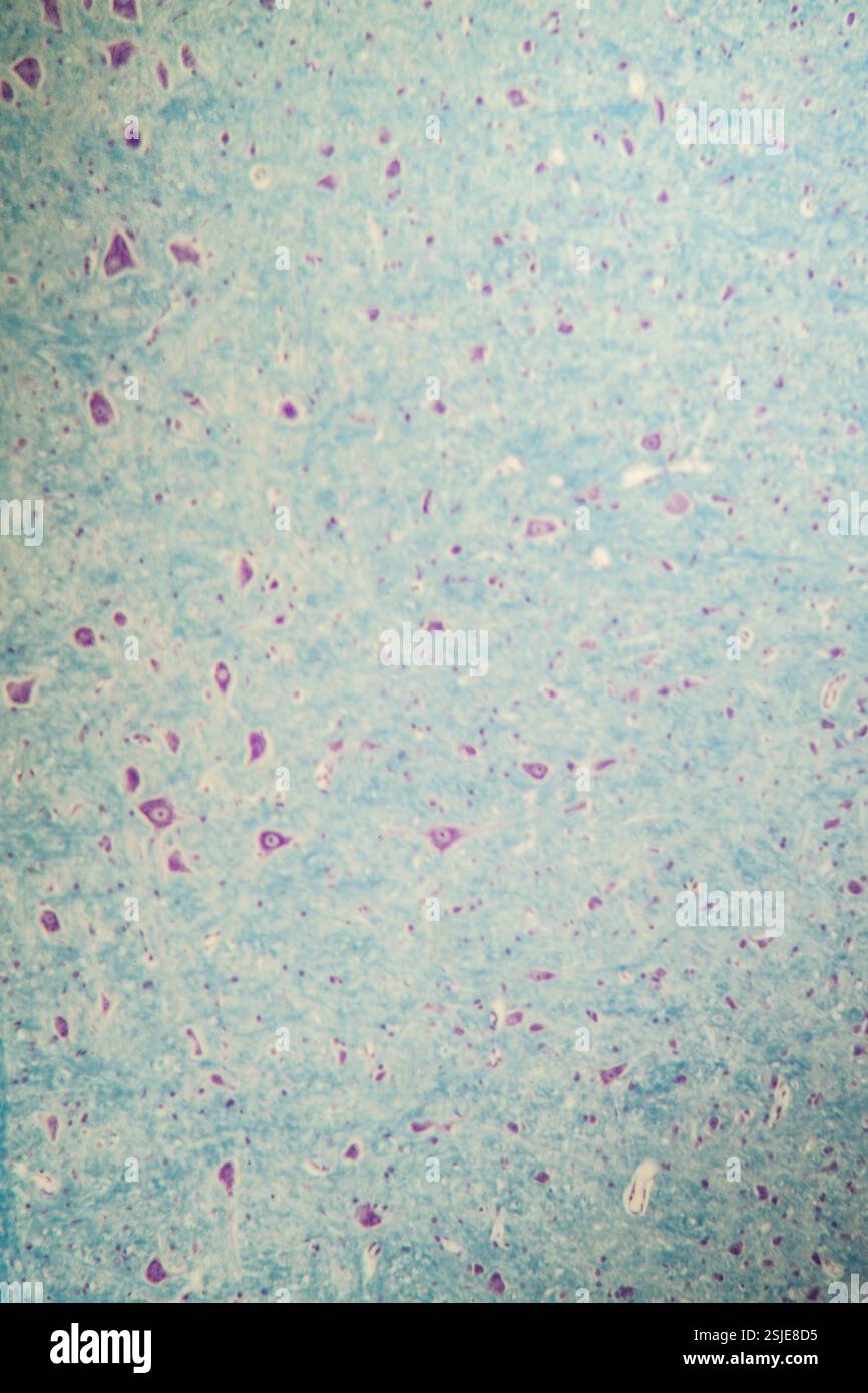 Nerve cells under the microscope 100x Stock Photo - Alamy