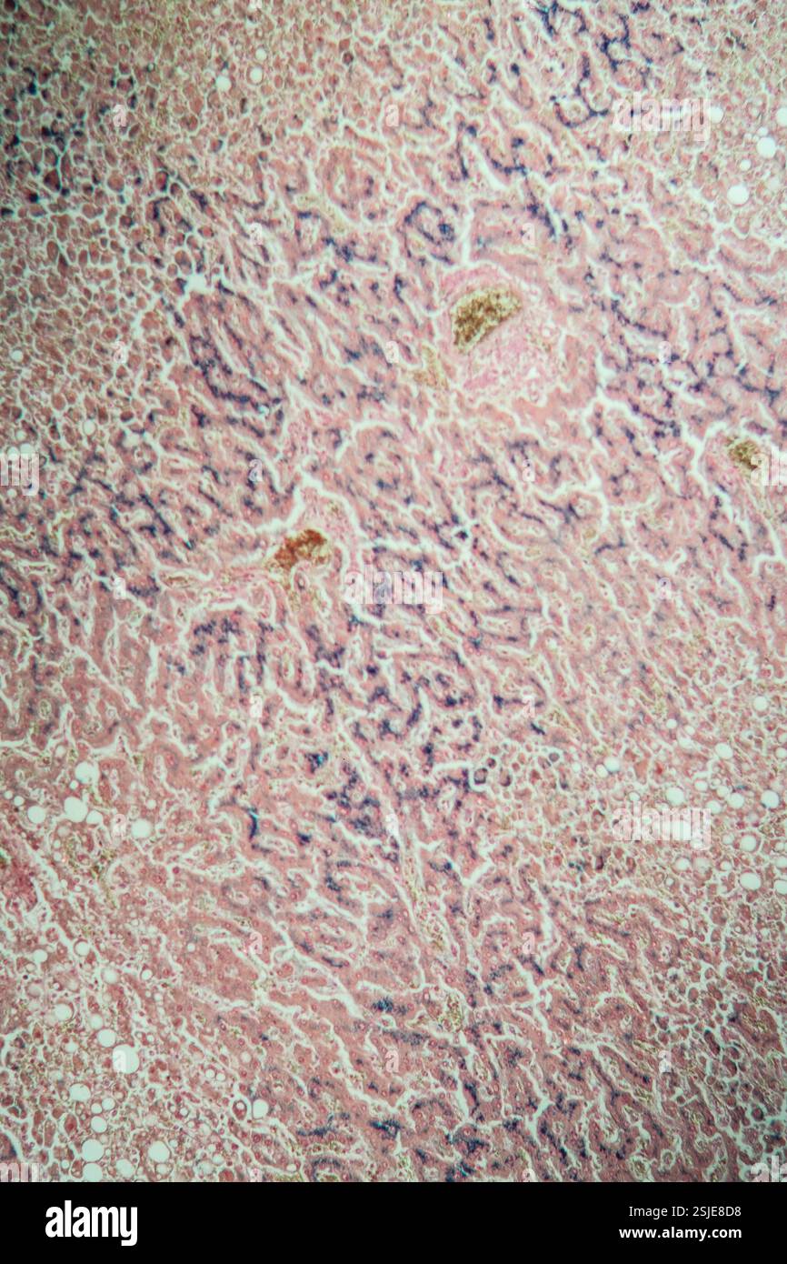 Histology liver hi-res stock photography and images - Alamy