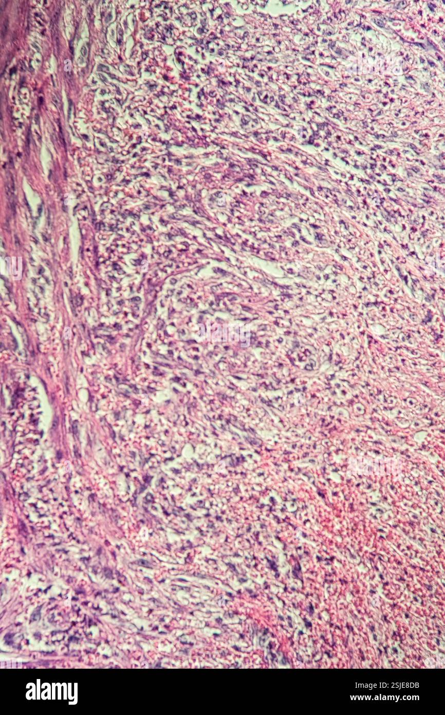 Gallbladder tissue under the microscope 200x Stock Photo - Alamy