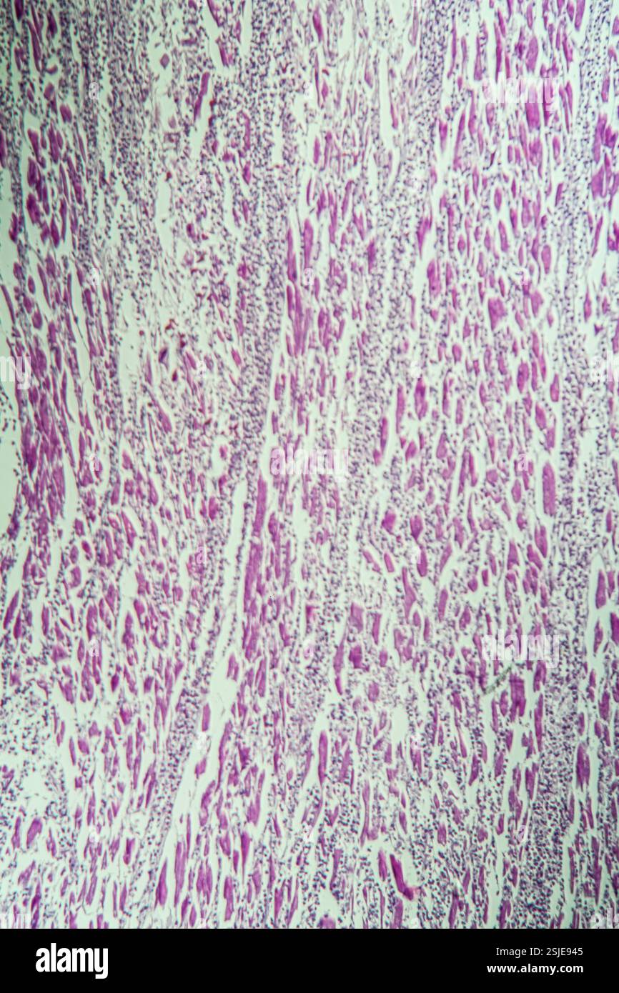 Inflamed heart muscle under the microscope 100x Stock Photo - Alamy