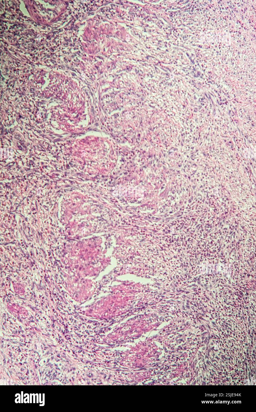 Gallbladder tissue under the microscope 100x Stock Photo - Alamy