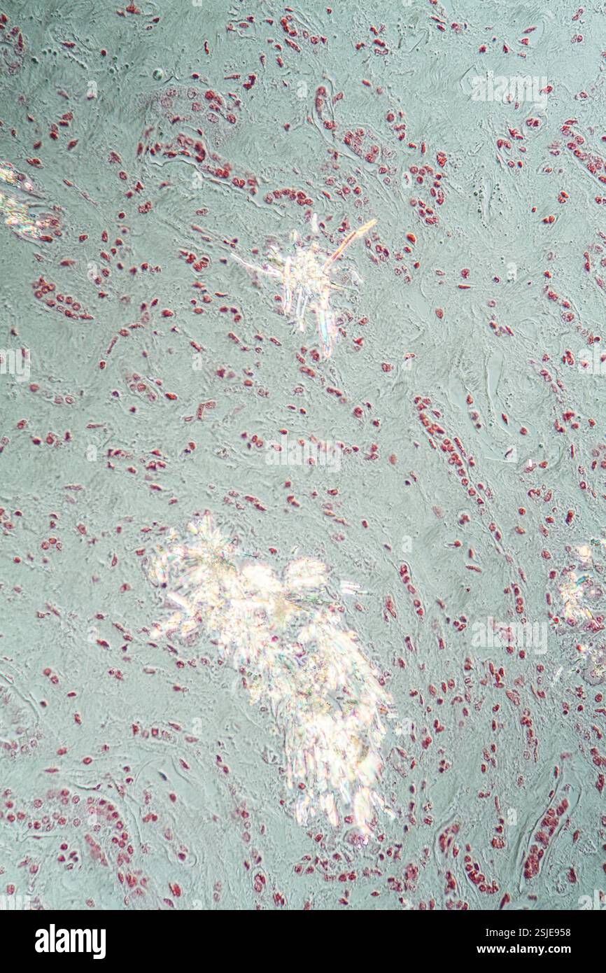 Medicine microscope microscopy kidney hi-res stock photography and ...