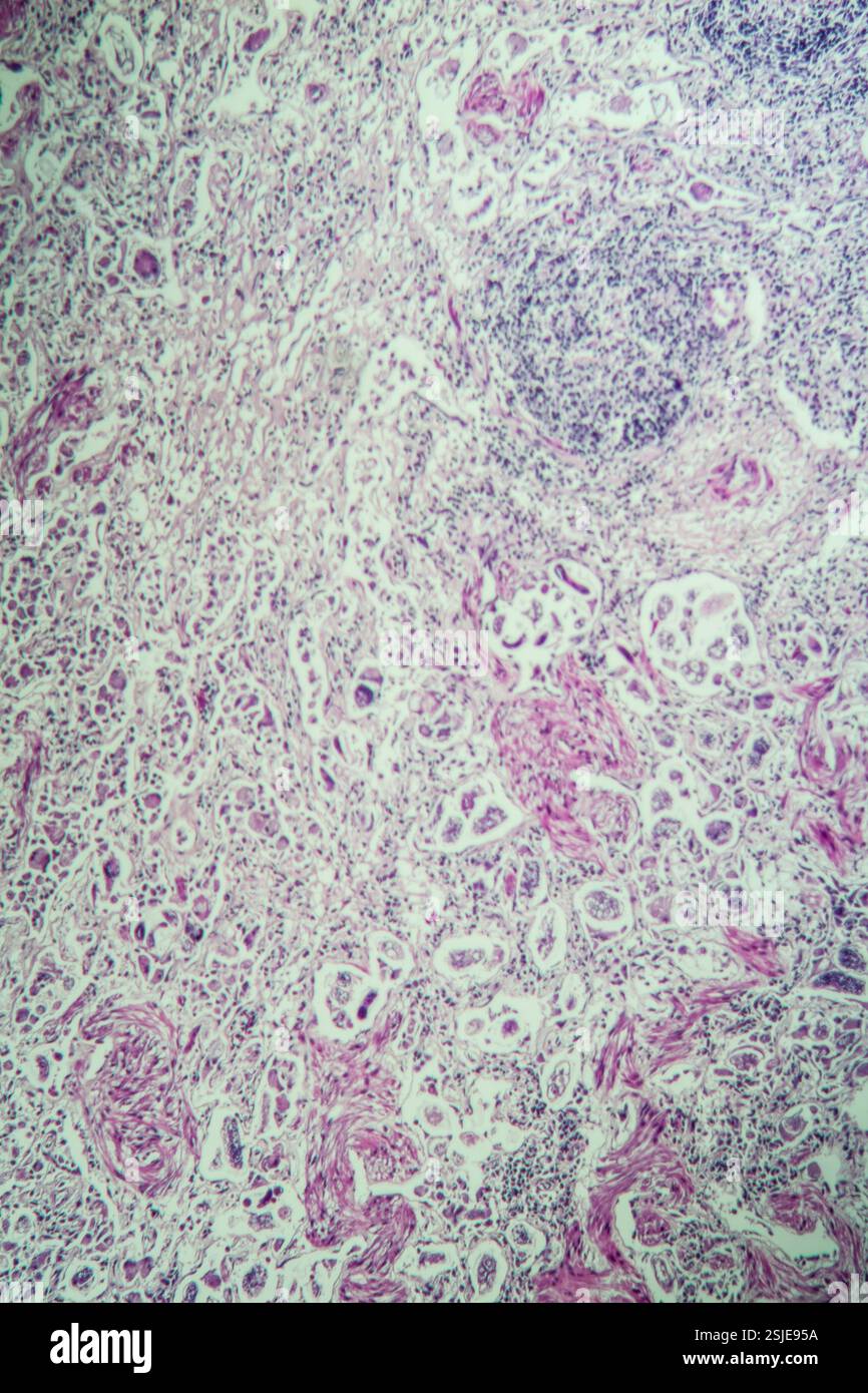 Lungworm in tissue under the microscope 100x Stock Photo - Alamy