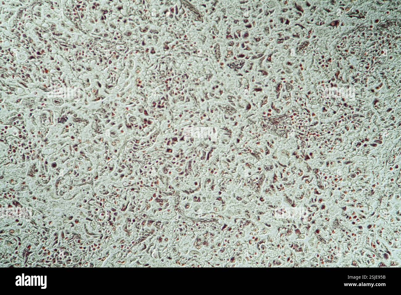 Pneumocyctis tissue under the microscope 100x Stock Photo - Alamy