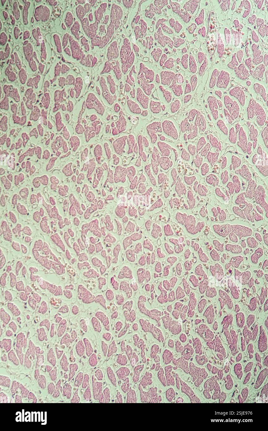 Cardiac tissue microscope hi-res stock photography and images - Alamy