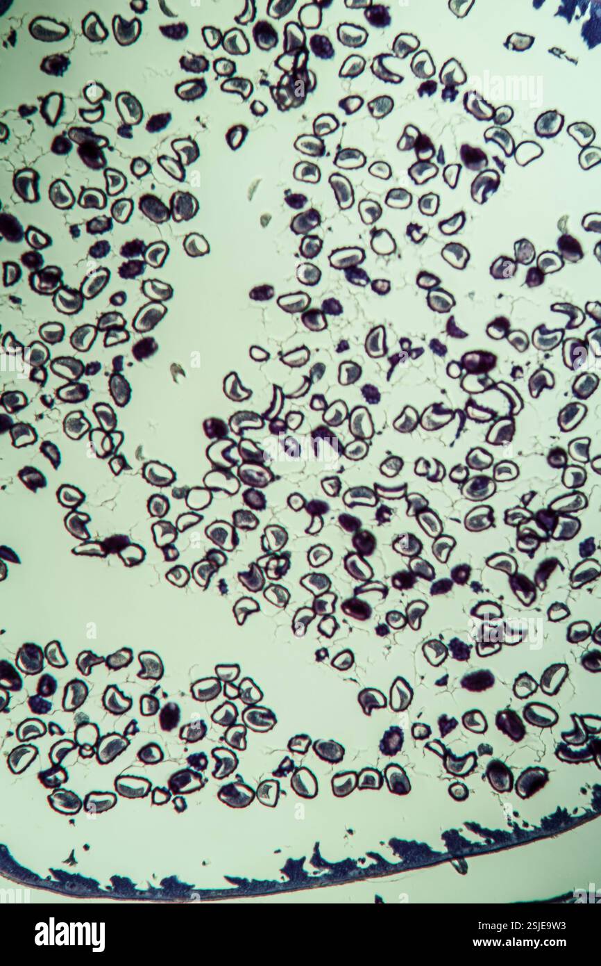 Horse roundworm cross section under the microscope 100x hi-res stock ...