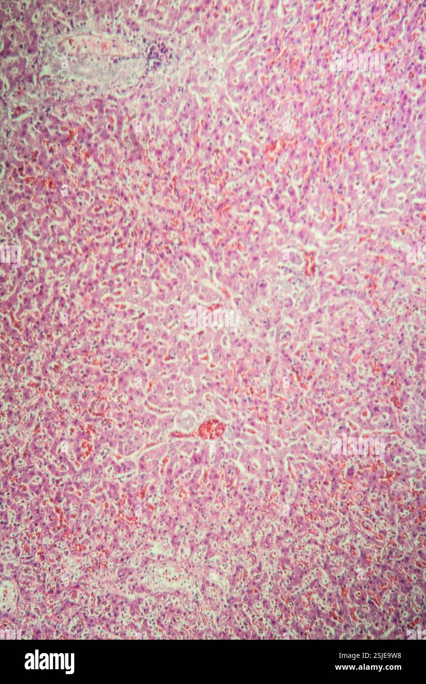 Hedgehog kidney after shock under the microscope 100x Stock Photo - Alamy