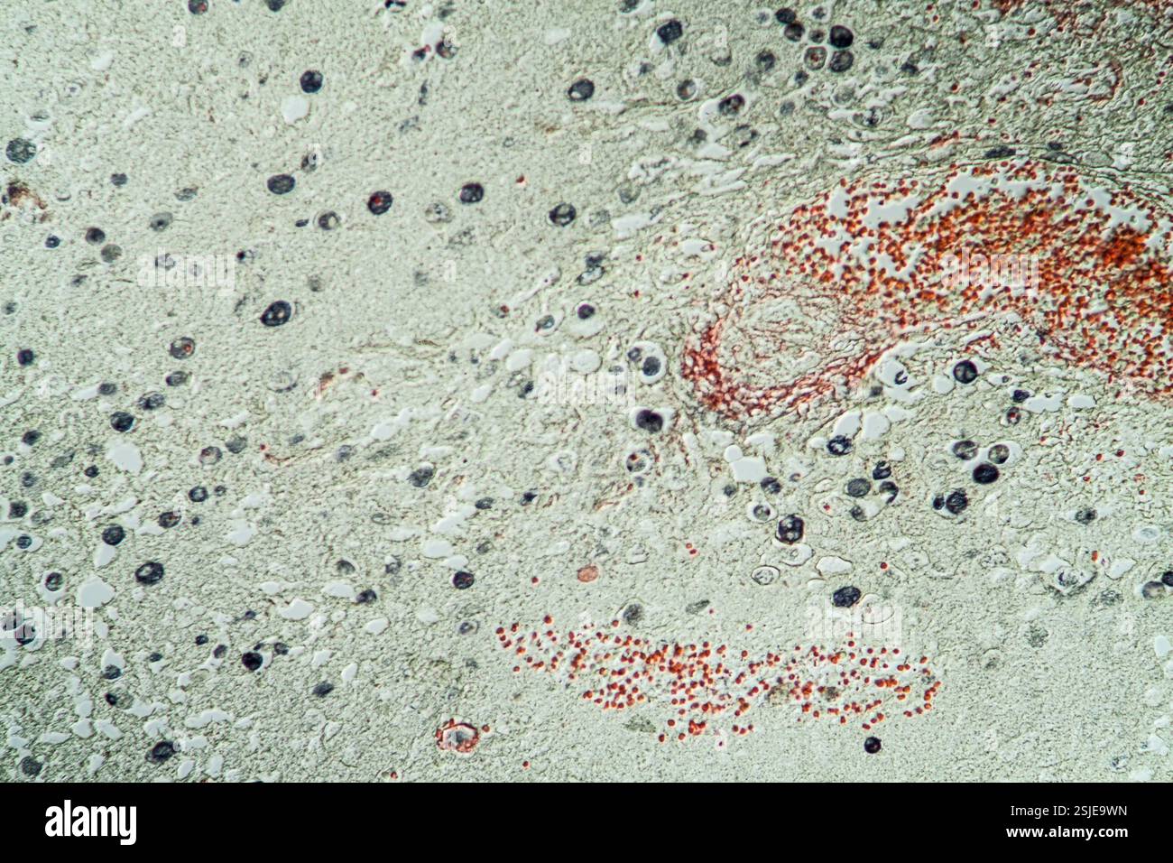 Parasite tissue under the microscope 200x Stock Photo - Alamy