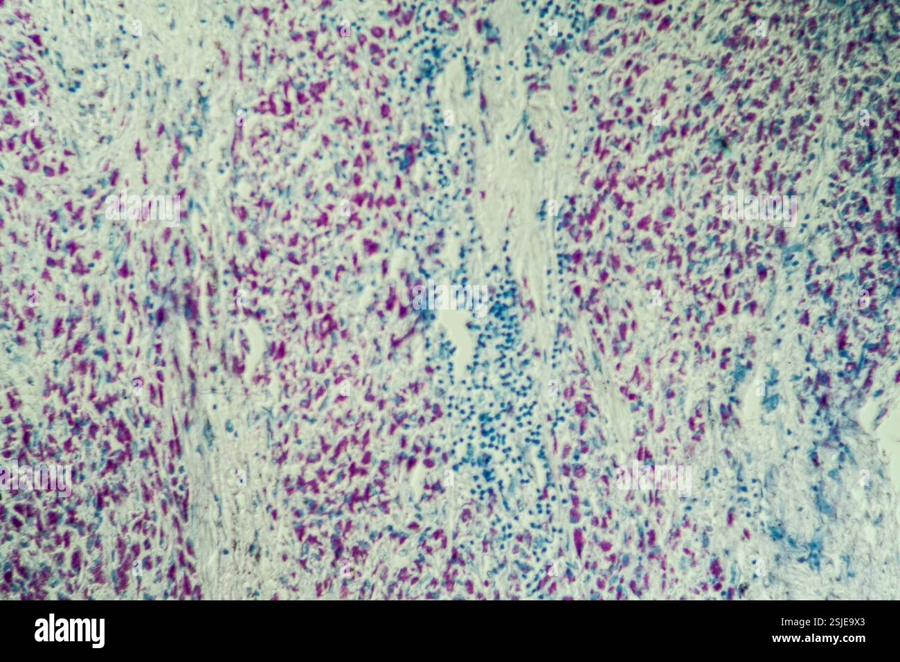 Virus bacteria under microscope hi-res stock photography and images - Alamy