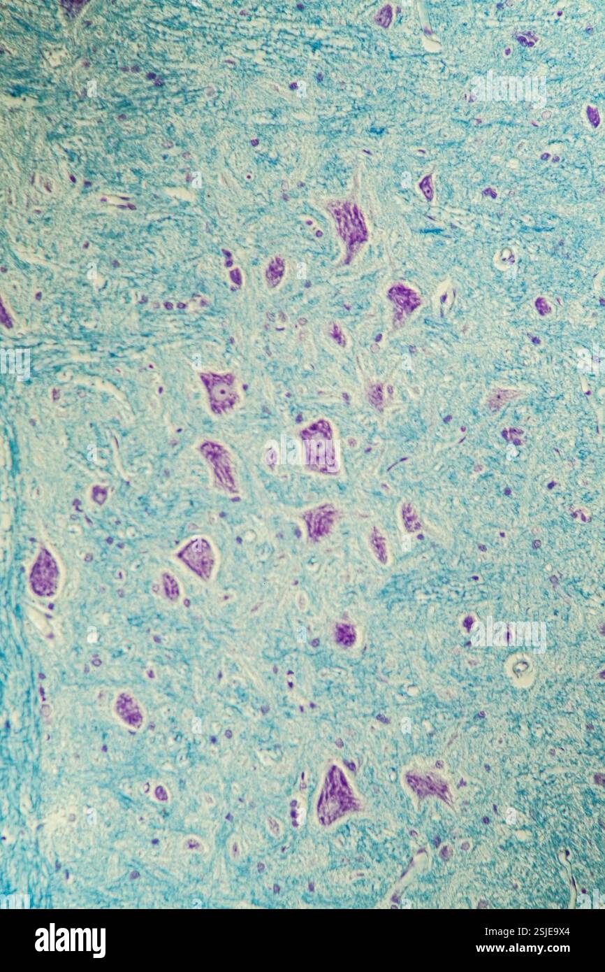 Nerve cells under the microscope 200x Stock Photo - Alamy