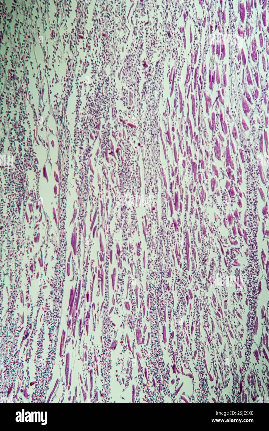 Inflamed heart muscle under the microscope 100x Stock Photo - Alamy