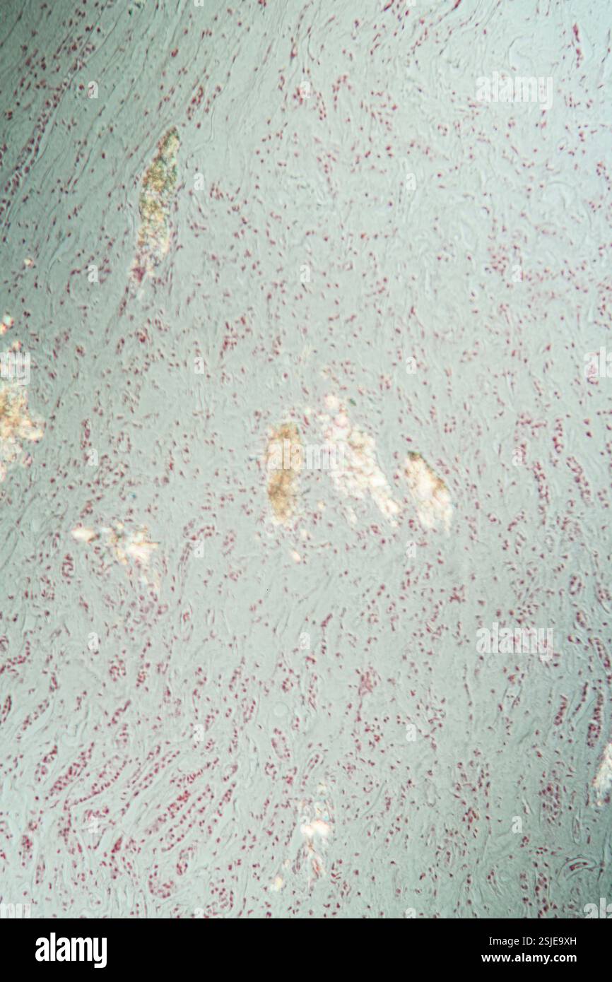 Lung tissue under the microscope 100x hi-res stock photography and ...