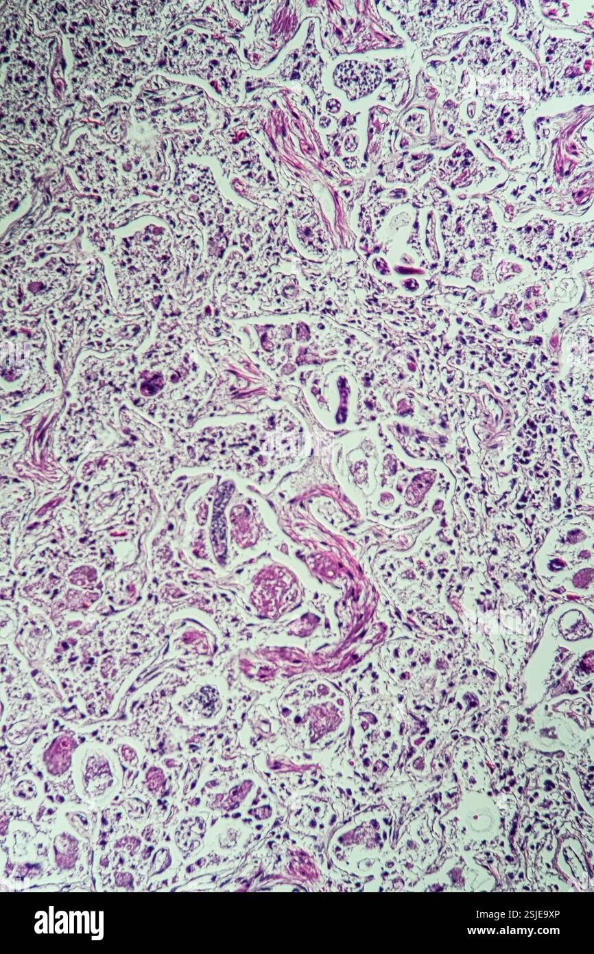 Lungworm in tissue under the microscope 200x Stock Photo - Alamy