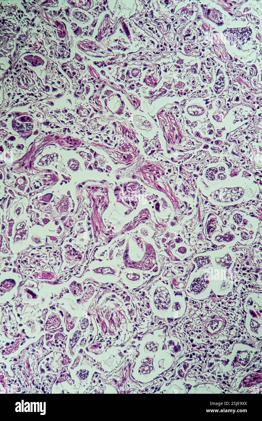 Lungworm in tissue under the microscope 200x Stock Photo - Alamy