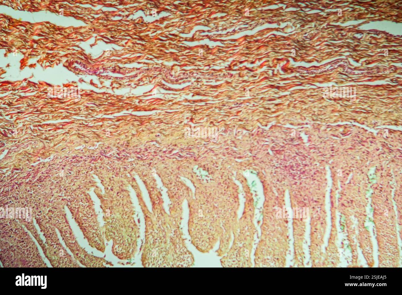 Diverticula in colon tissue under the microscope 100x Stock Photo - Alamy