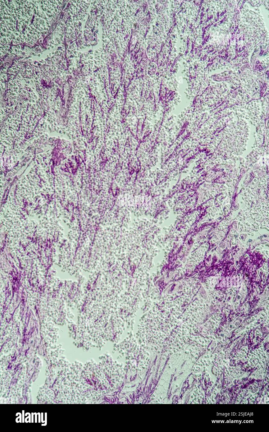Infection with Candida and Aspergillus 200x Stock Photo - Alamy