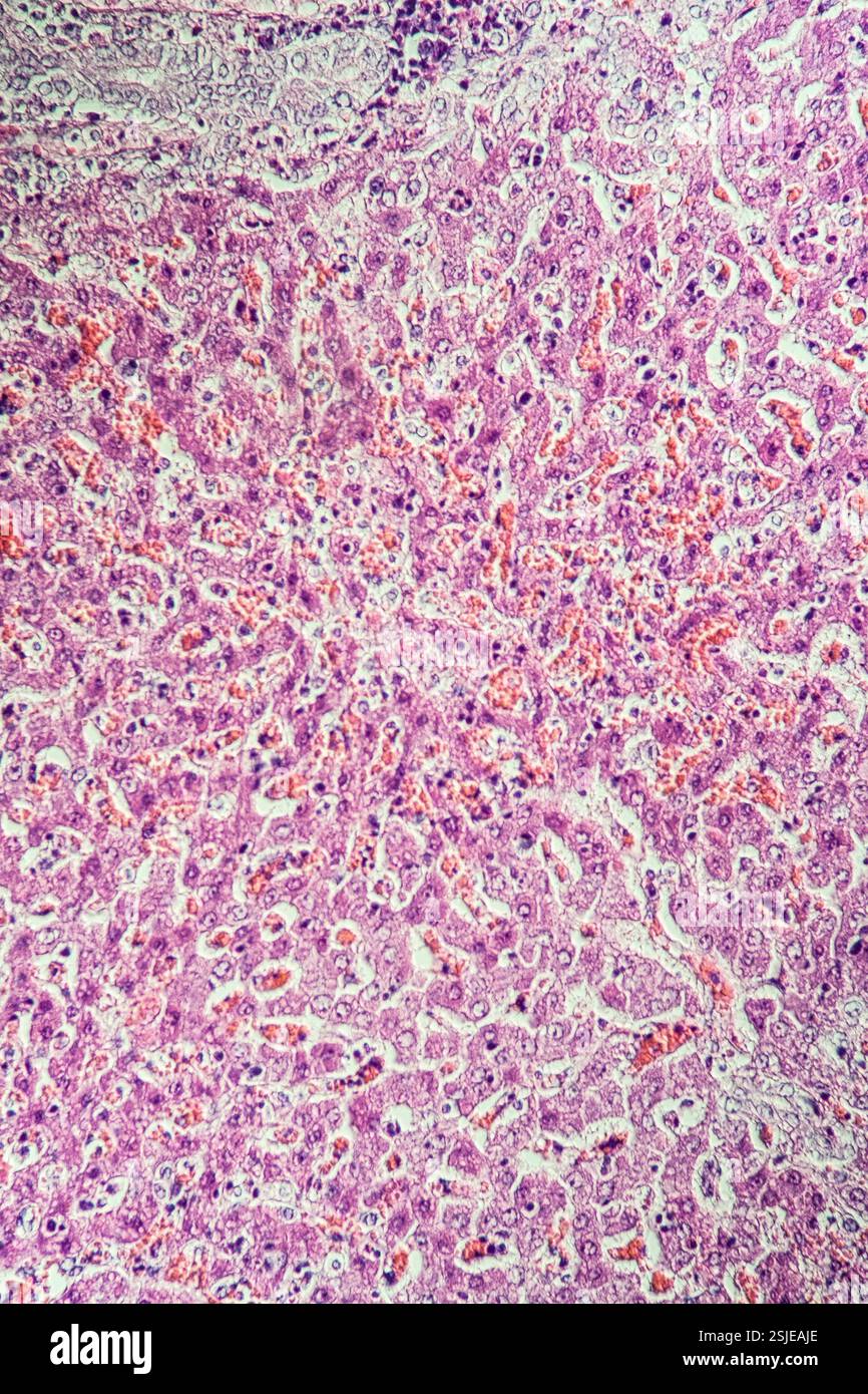 Hedgehog kidney after shock under the microscope 200x Stock Photo - Alamy