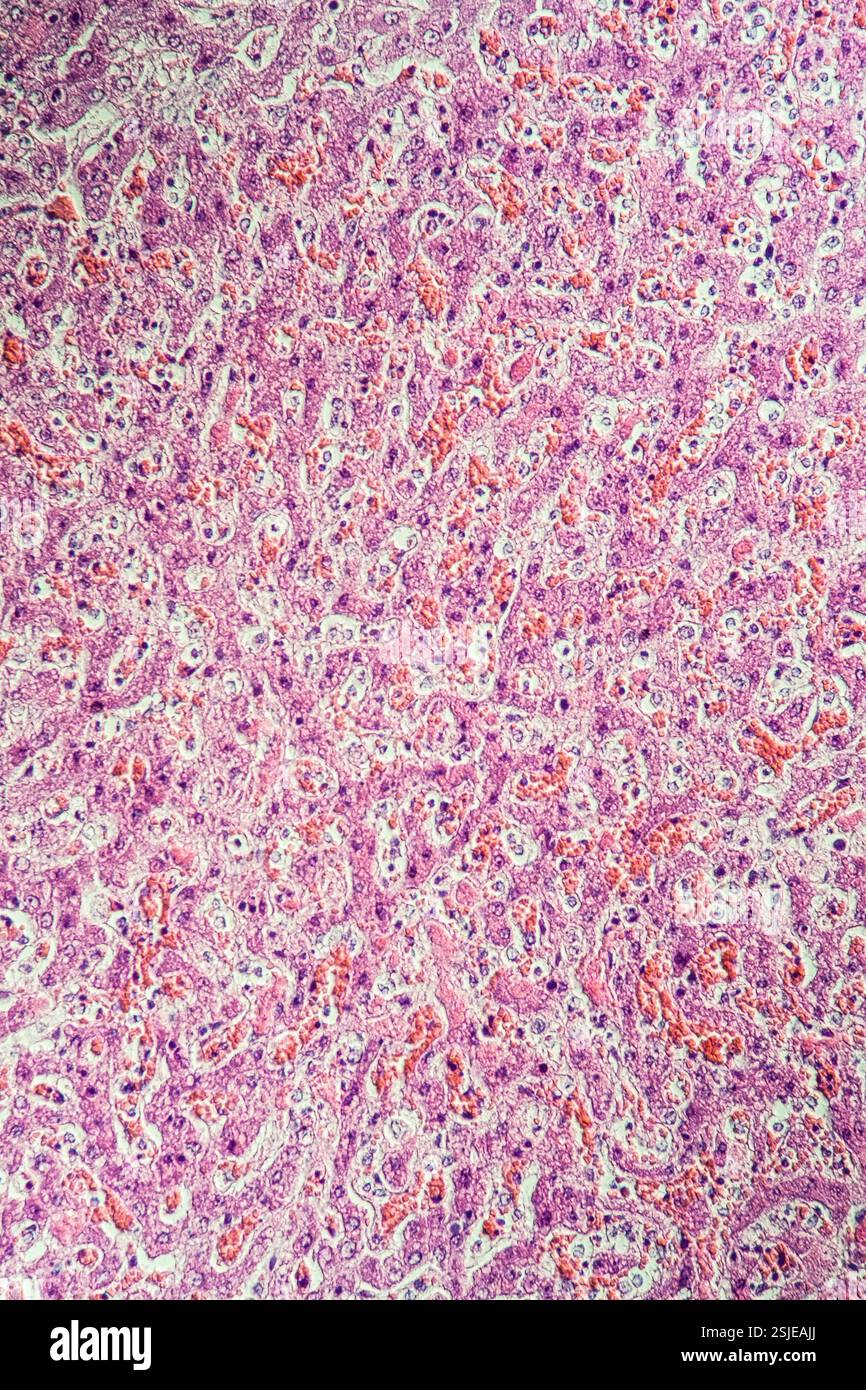 Hedgehog kidney after shock under the microscope 200x Stock Photo - Alamy