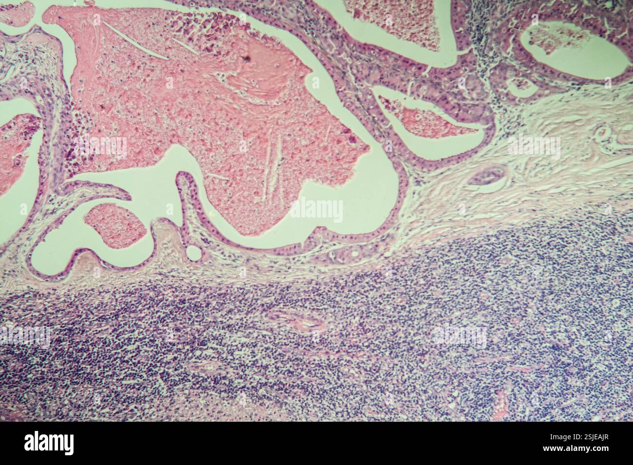Salivary glands hi-res stock photography and images - Alamy