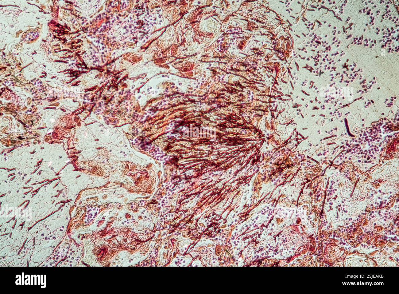 Lung tissue 200x Stock Photo - Alamy
