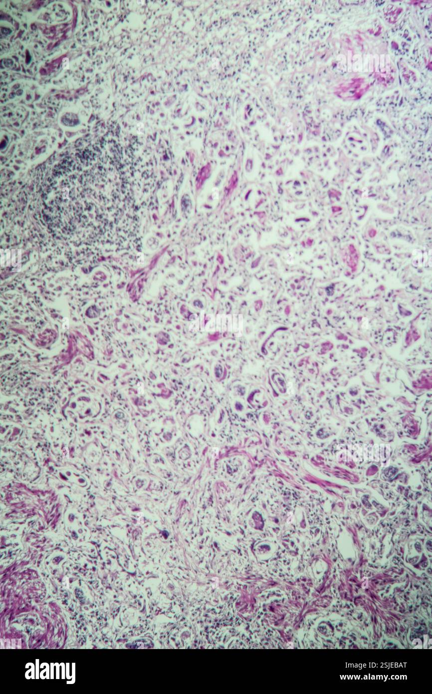 Lungworm in tissue under the microscope 100x Stock Photo - Alamy