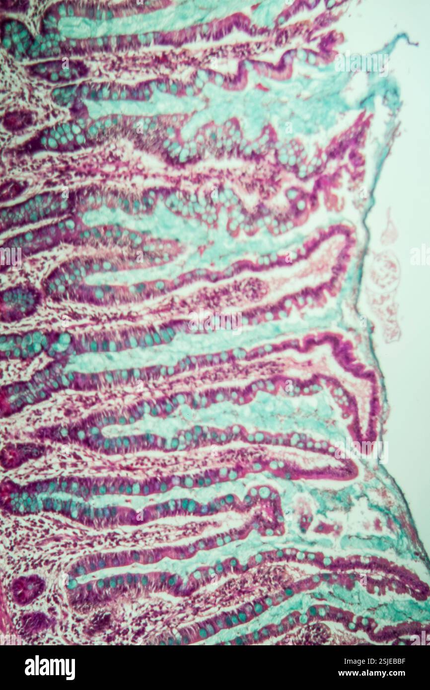 Small intestine with intestinal villi under the microscope 100x Stock ...