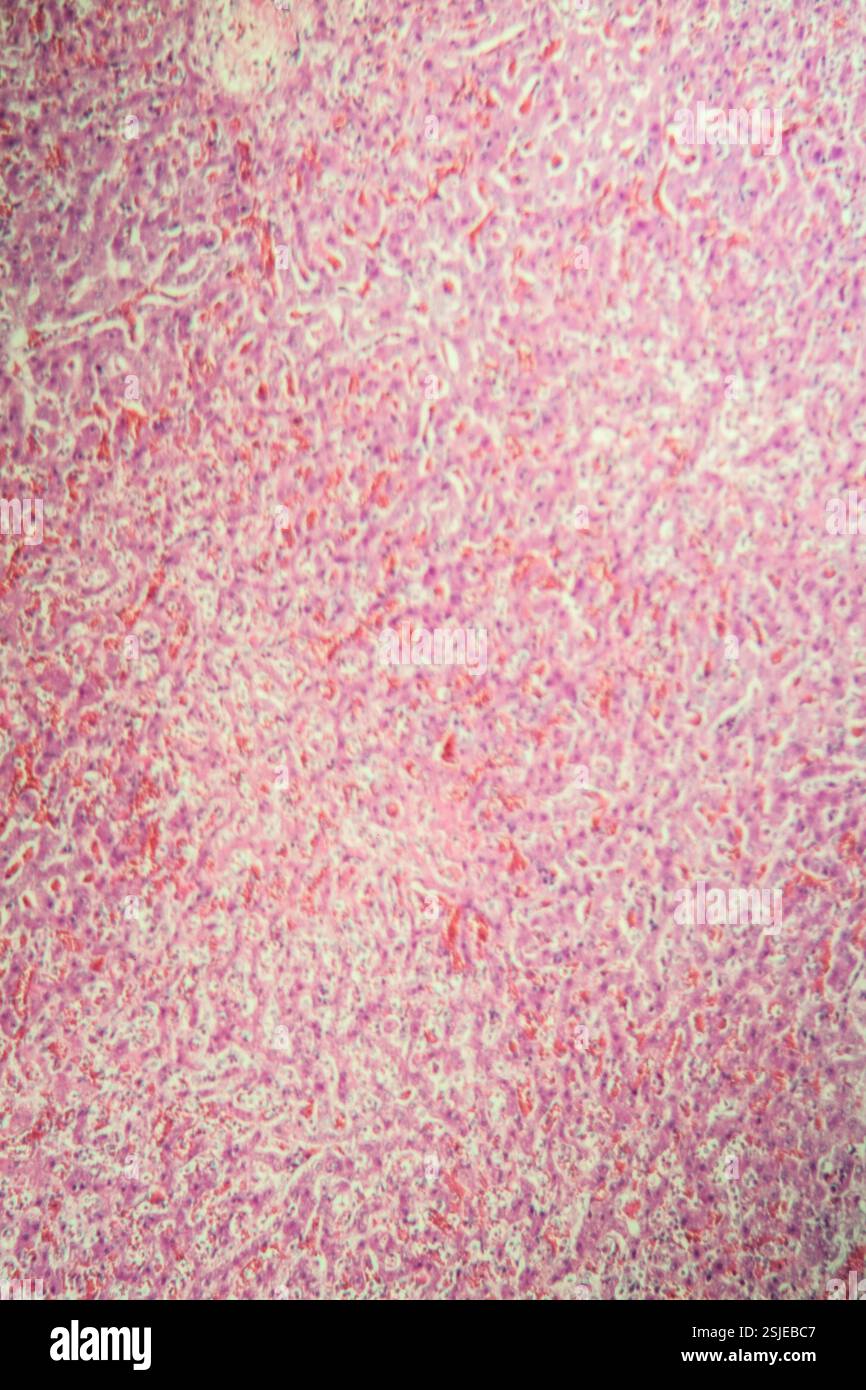 Hedgehog kidney after shock Tissue under the microscope 100x Stock ...