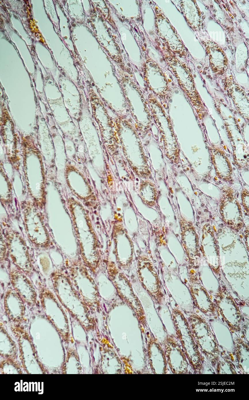 Healthy lung tissue under the microscope 200x Stock Photo - Alamy