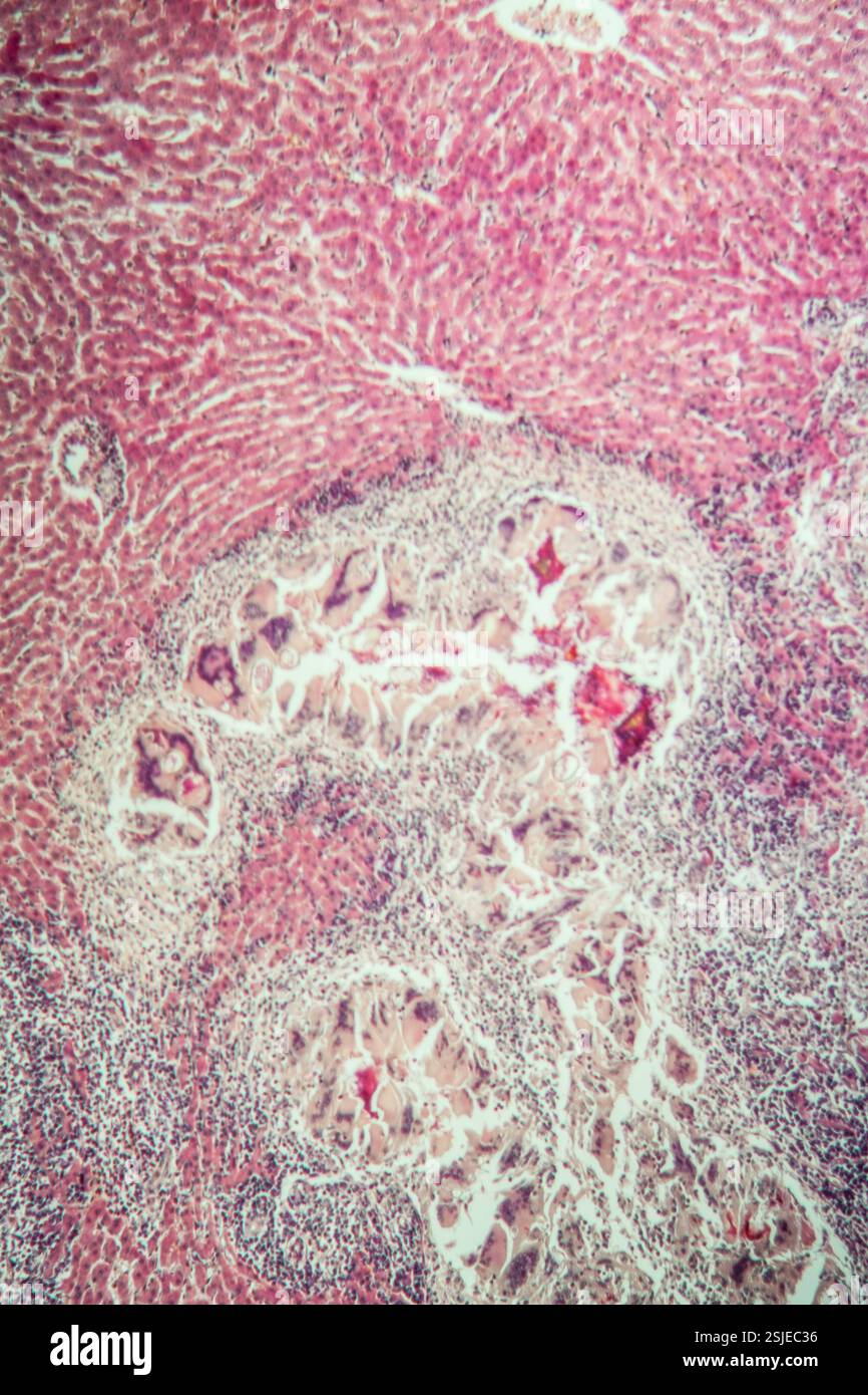 Parasite eggs in tissue under the microscope 100x Stock Photo - Alamy