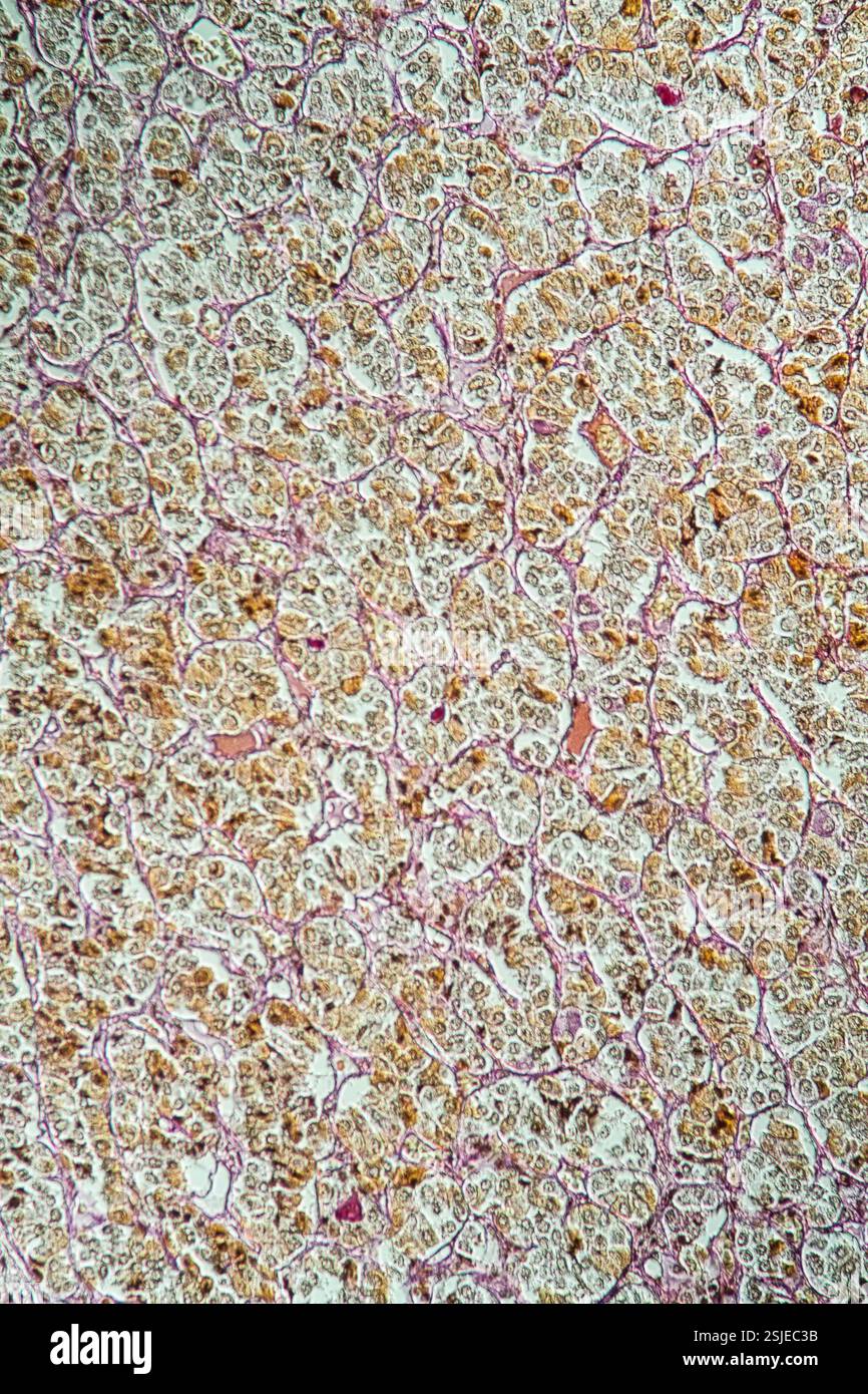 Pituitary gland under the microscope 200x Stock Photo - Alamy
