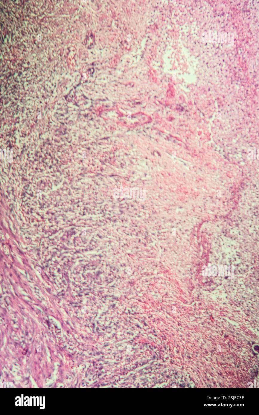 Gallbladder tissue under the microscope 100x Stock Photo - Alamy