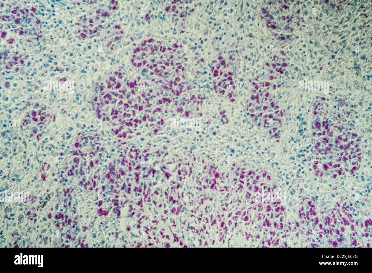 Virus bacteria under microscope hi-res stock photography and images - Alamy