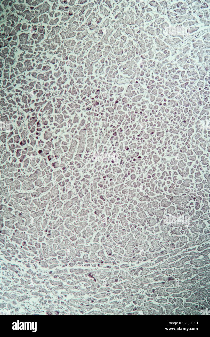 Diseased tissue under the microscope 100x Stock Photo - Alamy