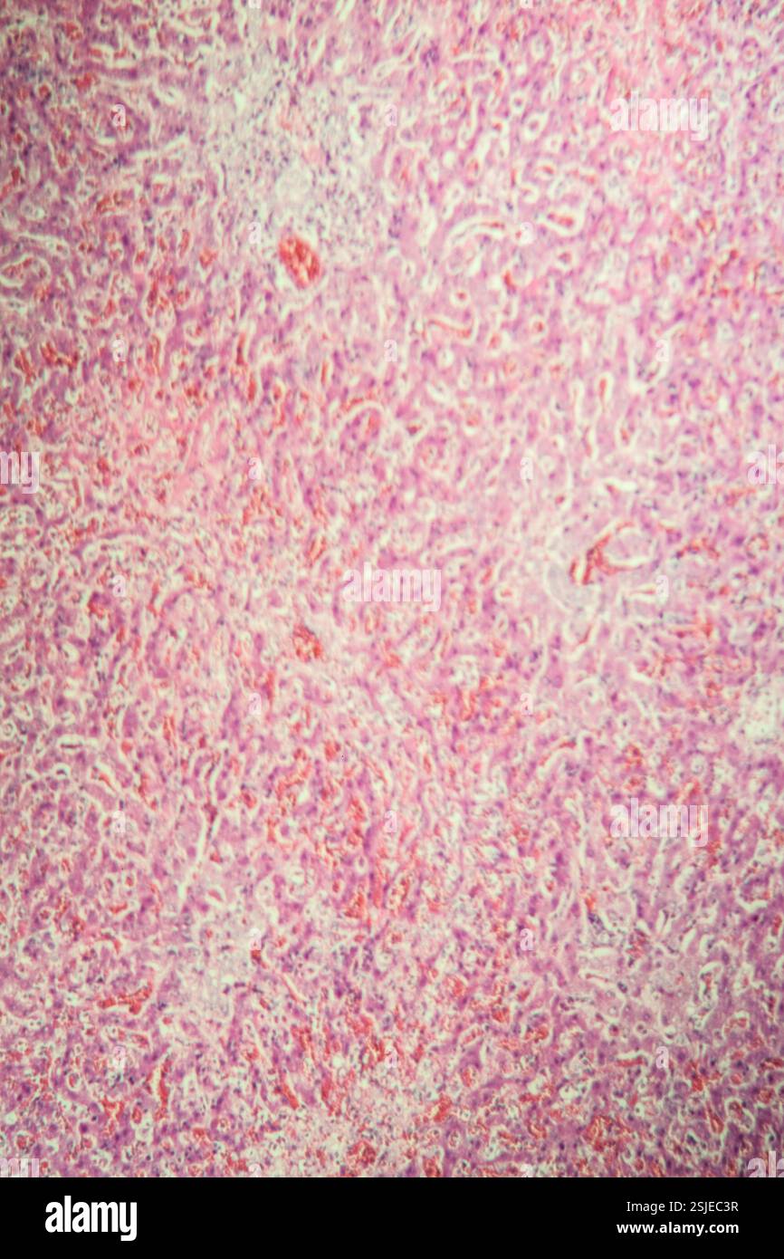 Hedgehog kidney after shock under the microscope 100x hi-res stock ...