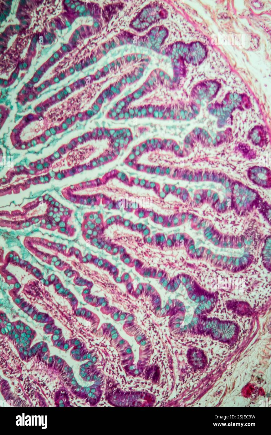 Small intestine with intestinal villi under the microscope 100x Stock ...